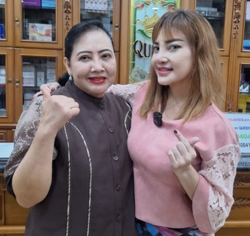 Buka Jahitan Operasi di Queen Klinik Sunter, Irma Darmawangsa Puas dengan Hidung Mancung ala ...